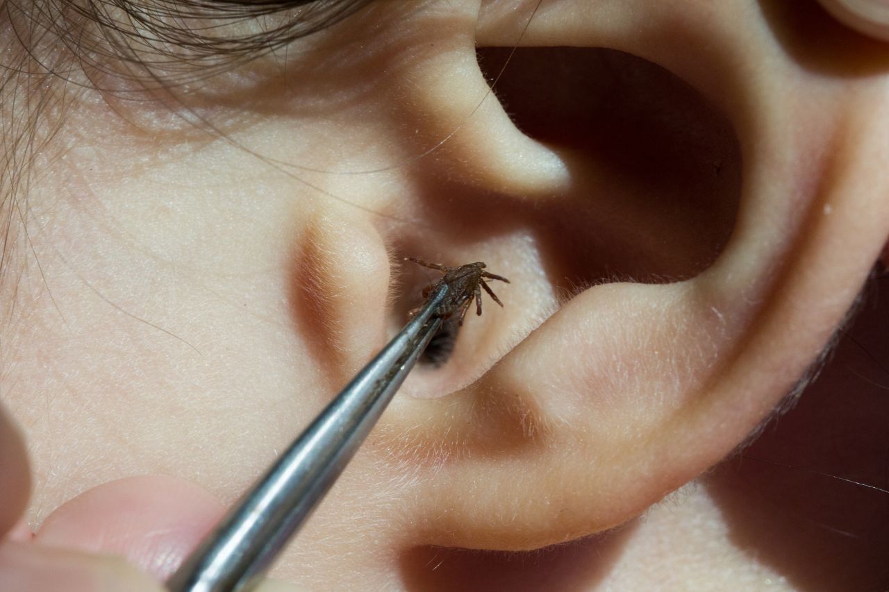 Most surprising ear health problems | Miracle-Ear