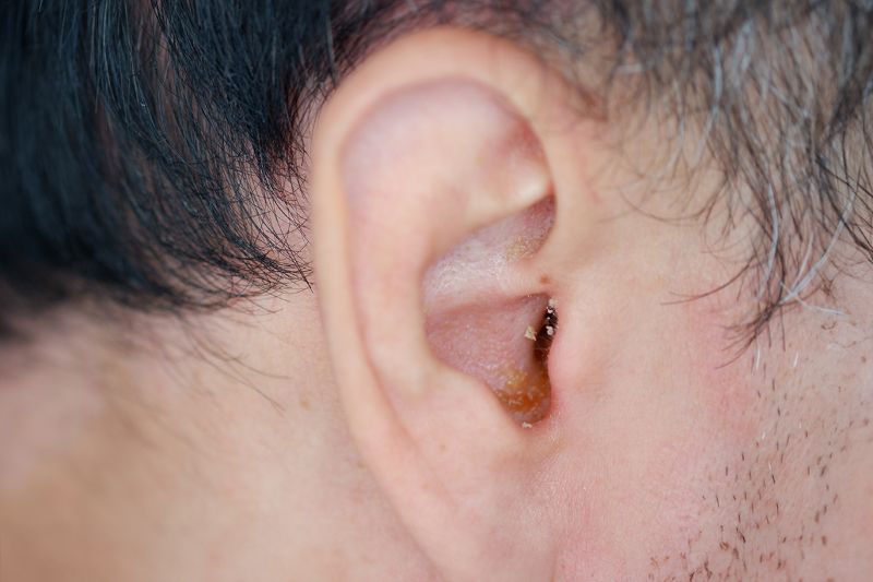 How to unclog ears from congestion and wax | Miracle-Ear