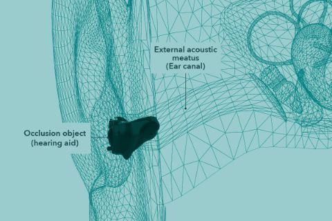 The occlusion effect: Causes & solutions | Miracle-Ear