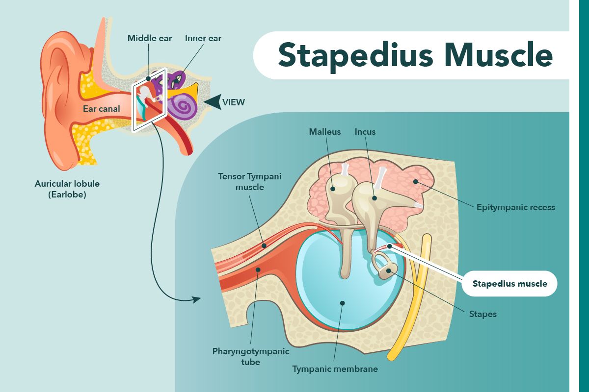 Middle ear myoclonus: Causes & treatment | Miracle-Ear