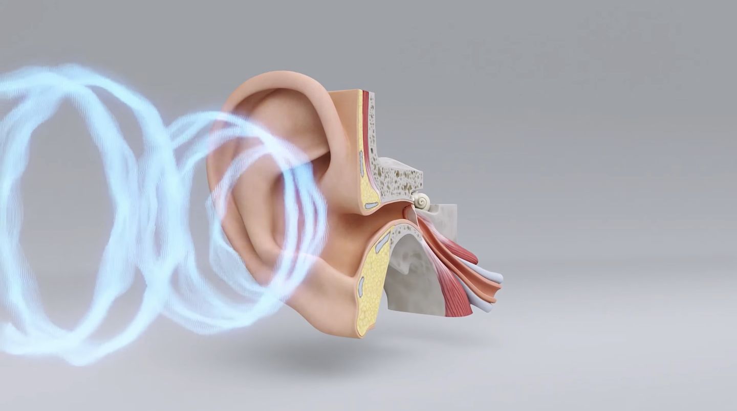 How hearing works: The purpose of hair cells │Miracle-Ear